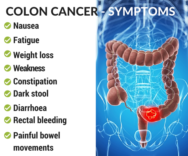 Colorectal Cancer Symptoms Causes Diagnosis Treatment Options Hot Sex