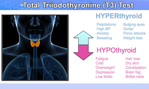 Book Total Triiodothyronine T3 Test Online At 35 Discount book-total-triiodothyronine-t3-test-online-at-35-discount
