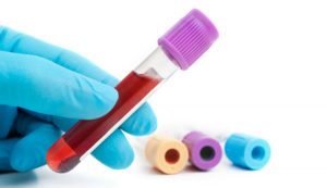 10 Things You Need to Know Before a Blood Test